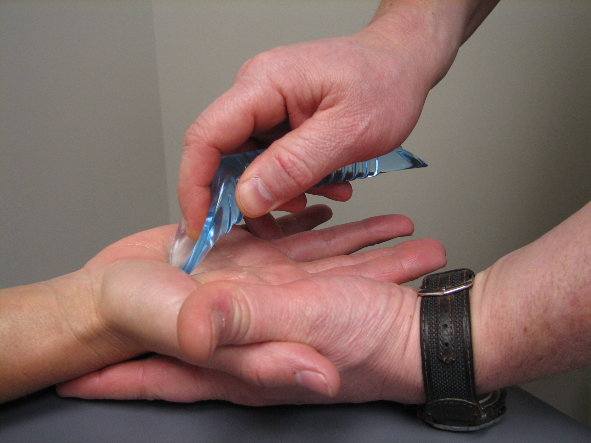 HAPPY HAPPY HAPPY Astym therapy helped my hand pain - Astym