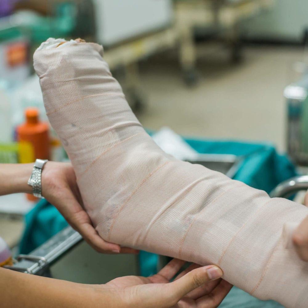 Read Patient Reviews of Astym Therapy | See How Astym Therapy Helps